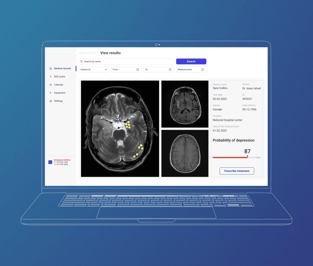 Facial Emotion Recognition Using Machine Learning