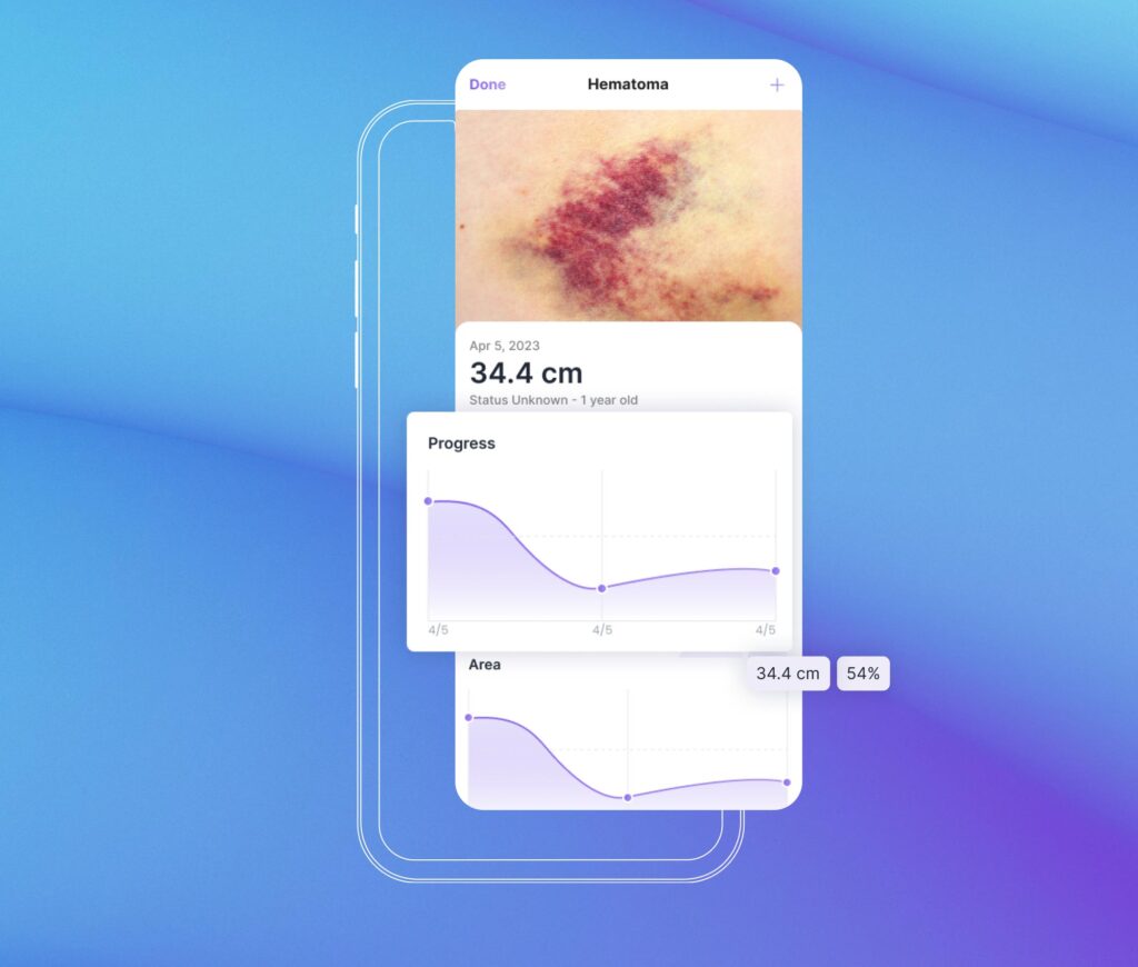 AI Remote Patient Monitoring Software | Innowise Case Study AI Remote Patient Monitoring Software | Innowise Case Study